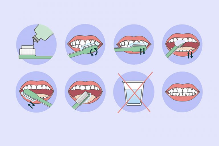 Odontia Tannlegene - Pusser du tenner på riktig måte?